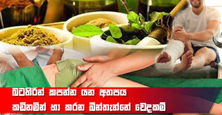 බටහිරින් කපන්න යන අතපය කඩිනමින් හා කරන බින් තැන්නේ වෙදකම් - Aruna